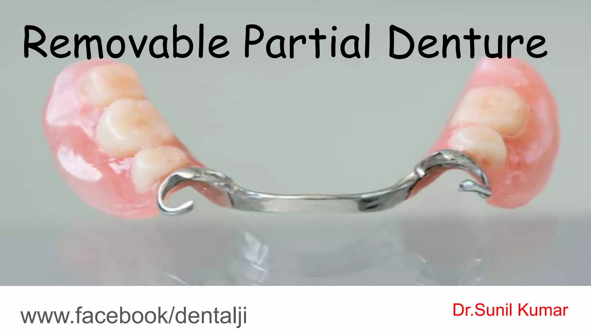 Removable Partial Denture Introduction Part 1 Pdf