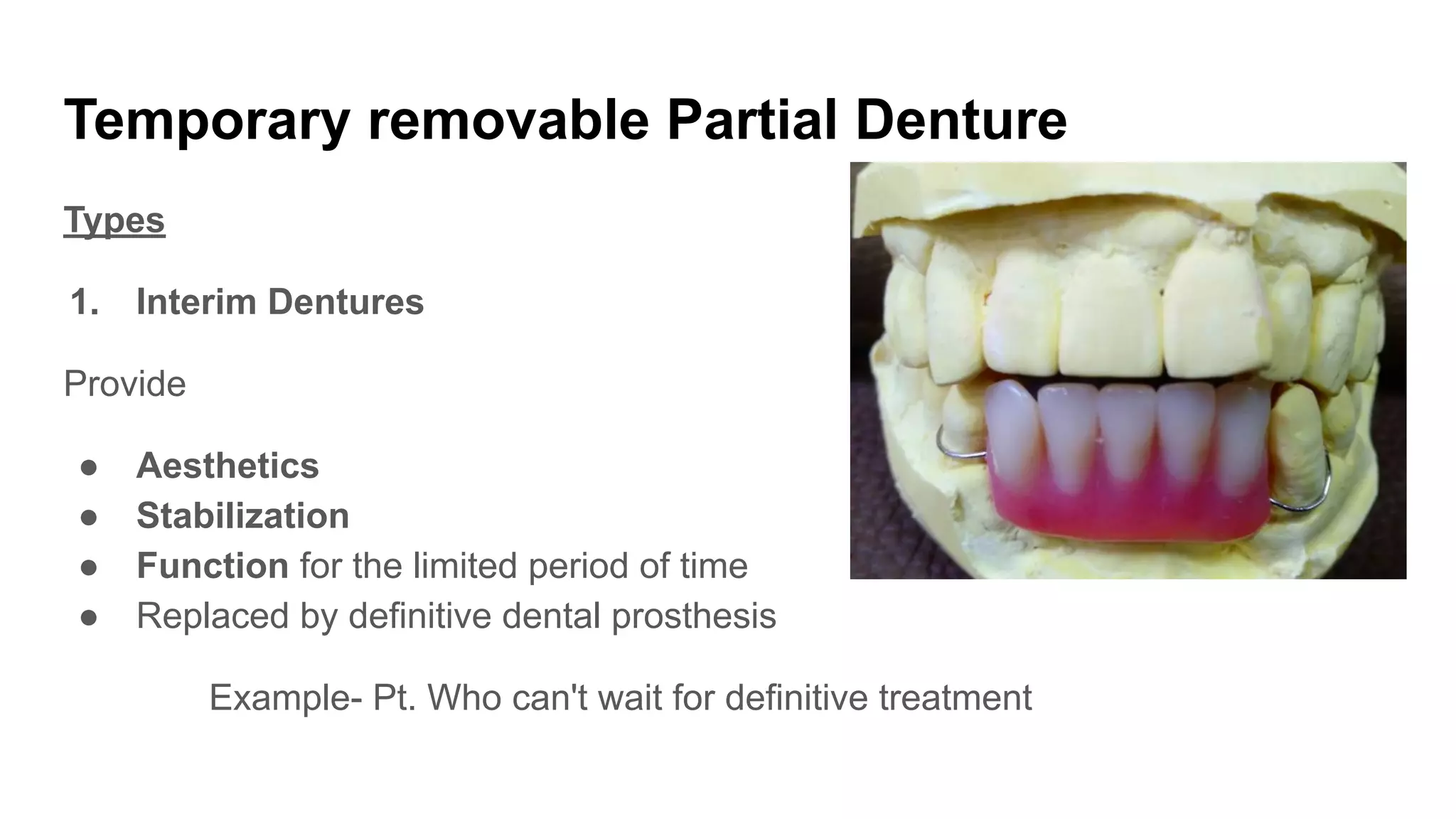 Removable partial denture introduction (part 1) | PDF