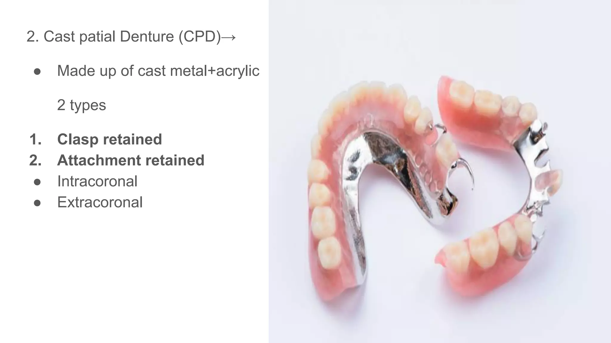 Removable partial denture introduction (part 1) | PDF