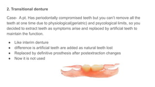 Removable partial denture introduction (part 1) | PDF