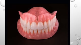 Removable Partial denture پروستودنتیکس سوم ۱.pptx