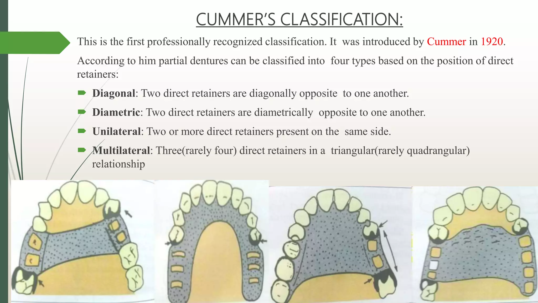 Removable Partial Denture Equation | PPTX