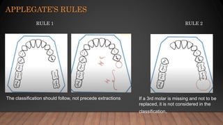 Removable partial dentures | PPT