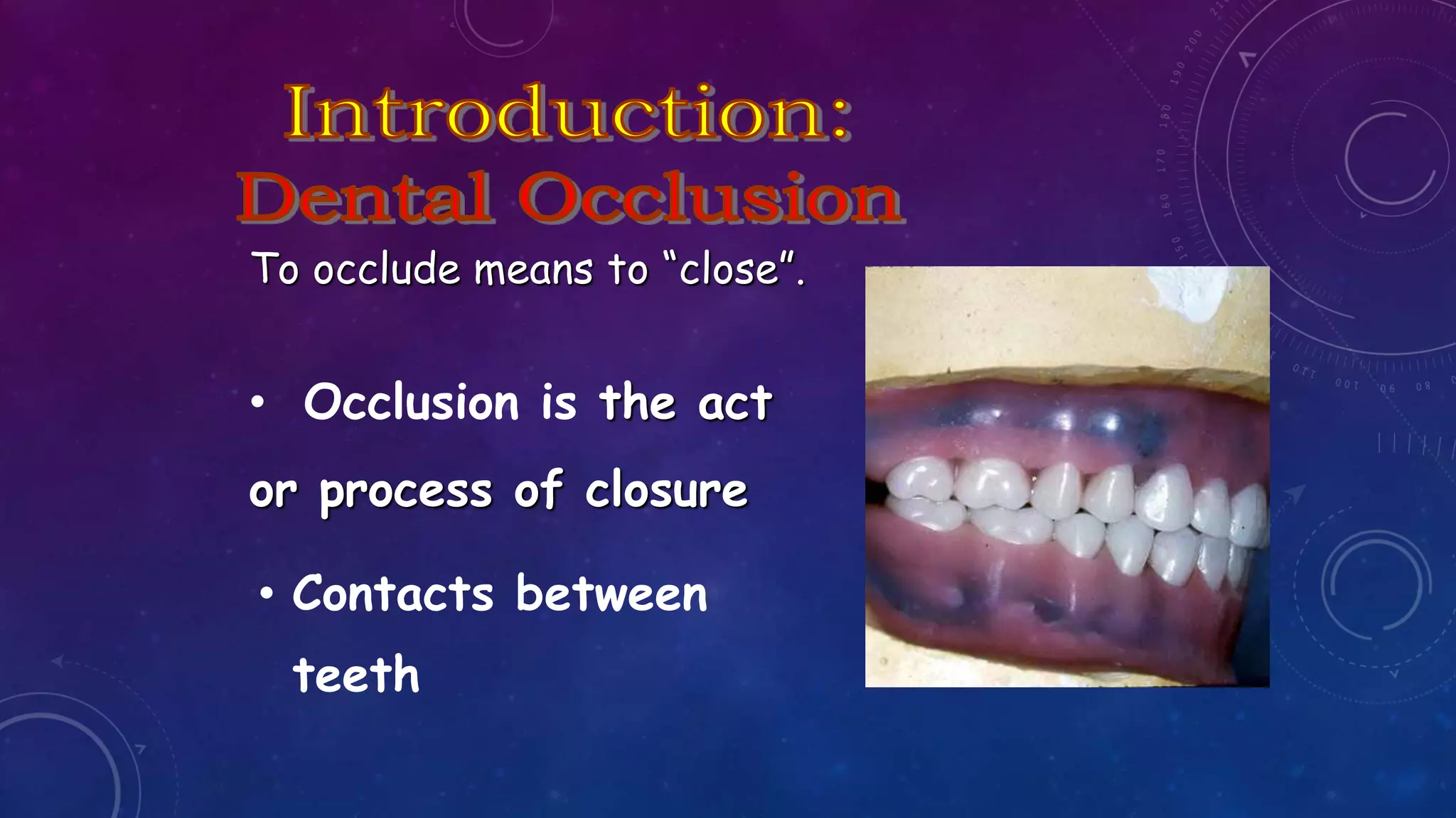 Removable Prosthodontics occlusion (1).pptx