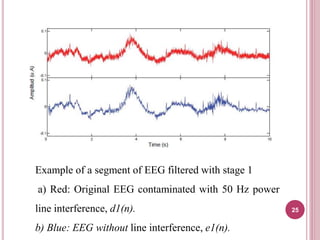 Removal of artifacts in EEG by averaging and | PPTX