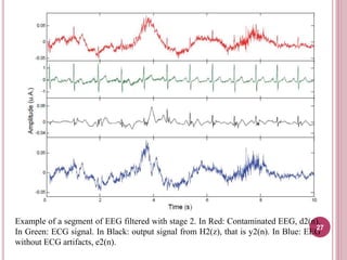Removal of artifacts in EEG by averaging and | PPTX
