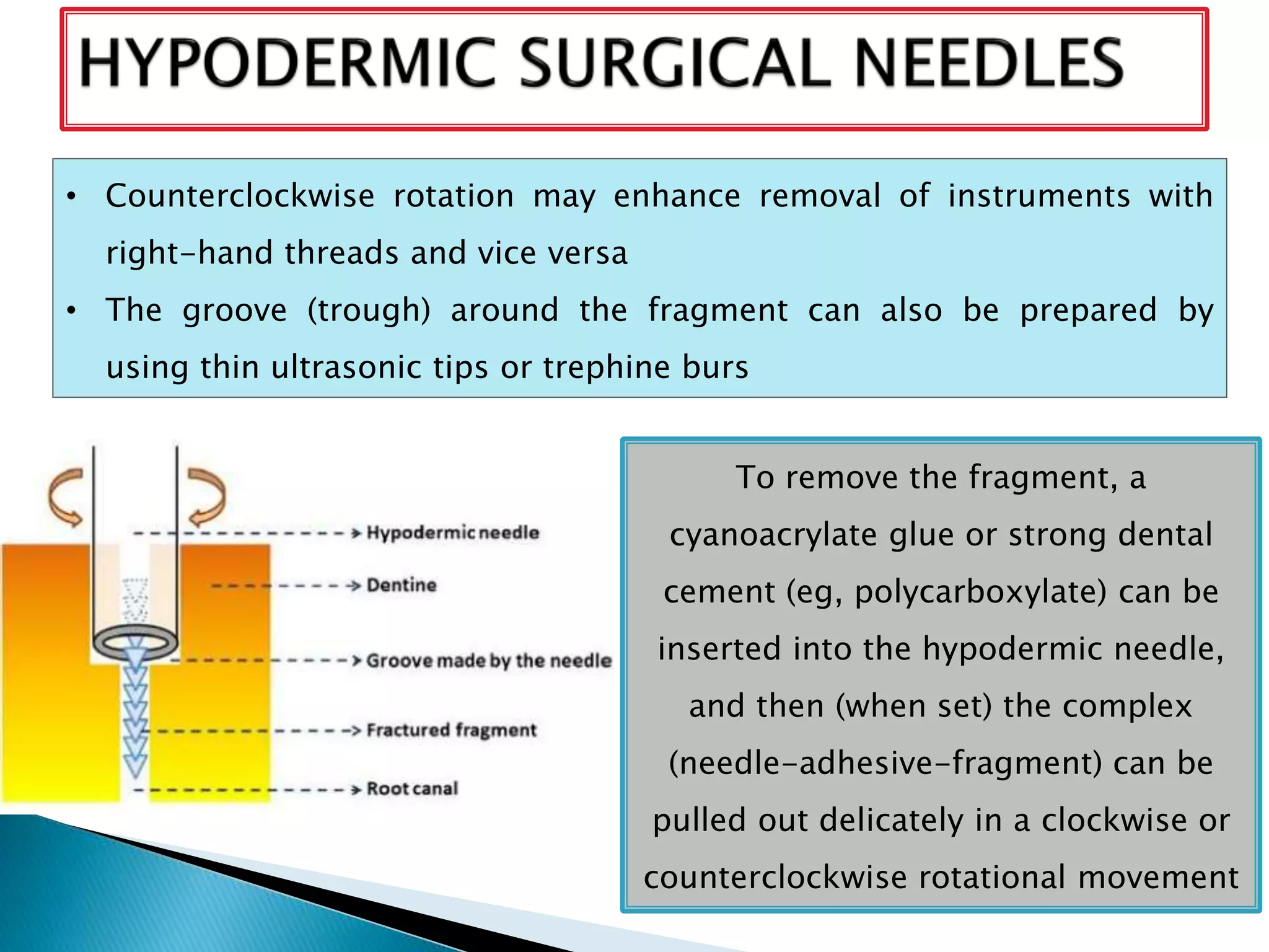Removal of broken endodontic instruments | PPTX