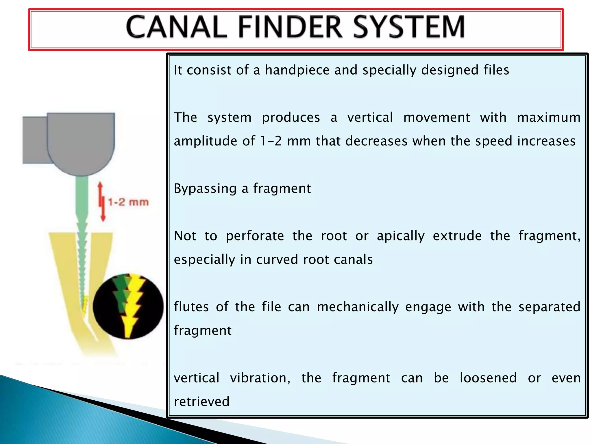 Removal of broken endodontic instruments | PPTX
