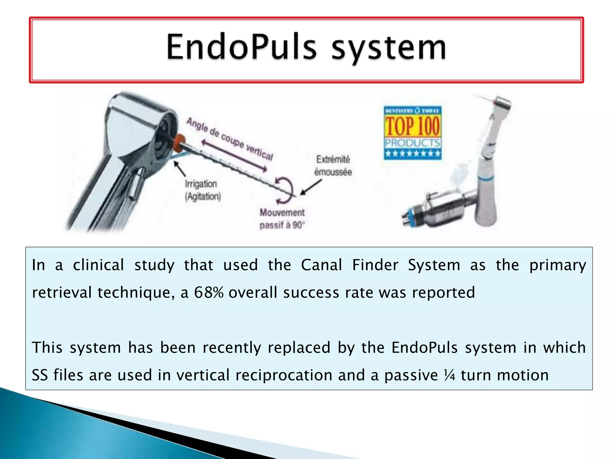 Removal of broken endodontic instruments | PPTX