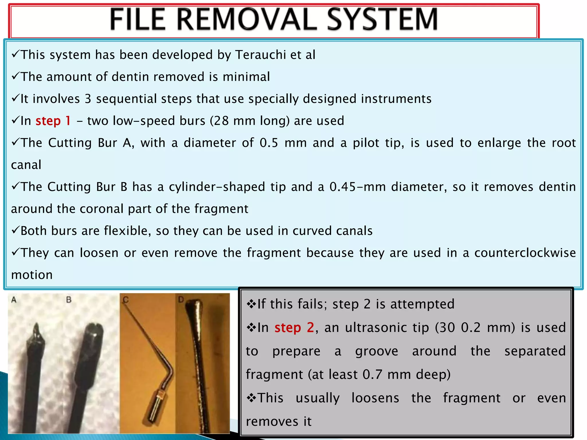 Removal of broken endodontic instruments | PPTX