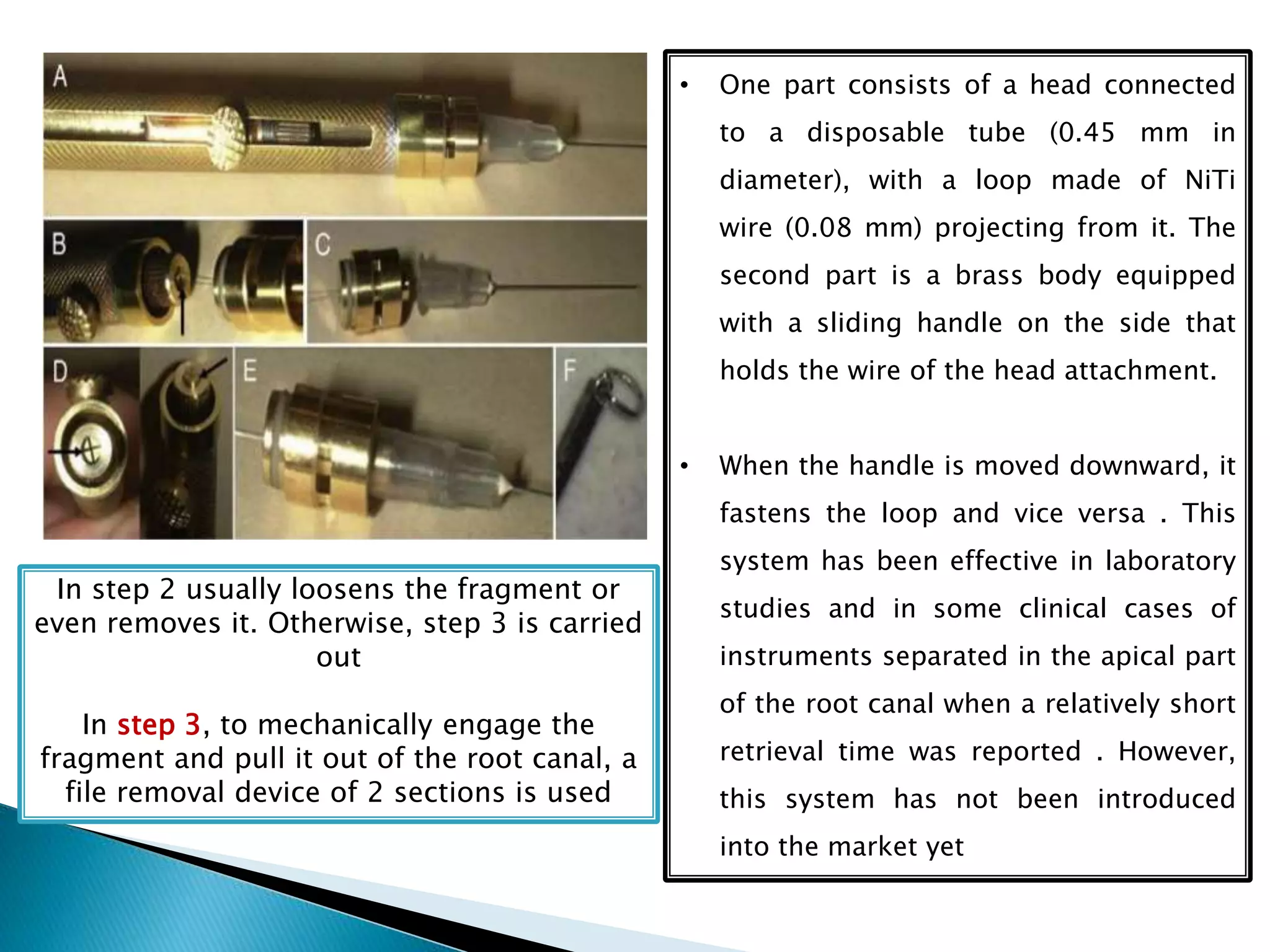 Removal of broken endodontic instruments | PPTX