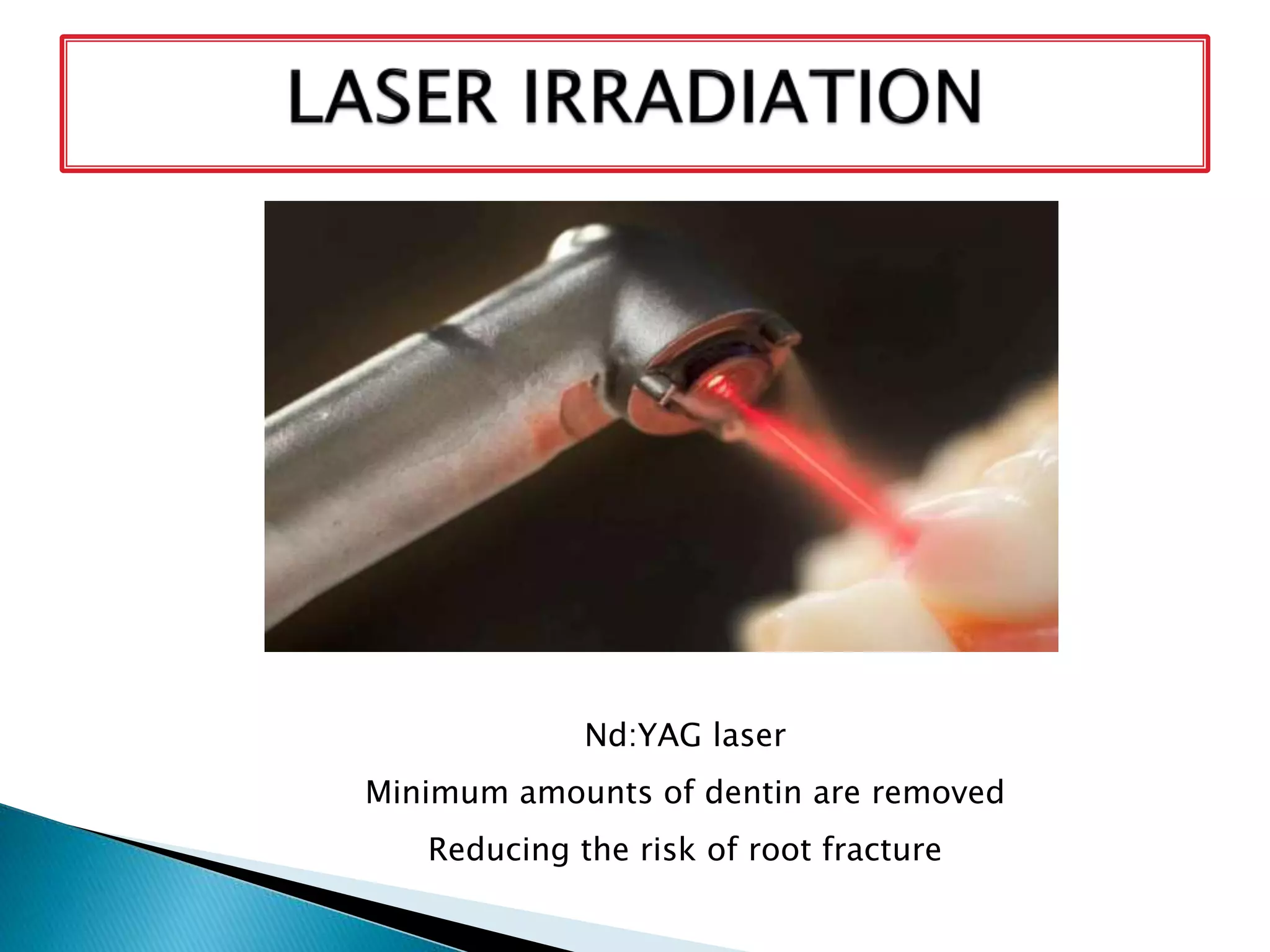 Removal of broken endodontic instruments | PPTX