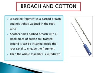 Removal of broken endodontic instruments | PPTX