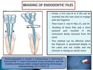 Removal of broken endodontic instruments | PPTX