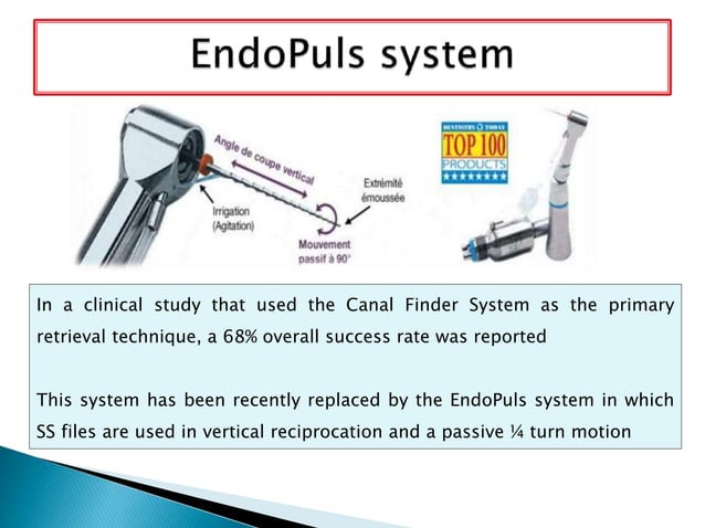 Removal of broken endodontic instruments | PPTX