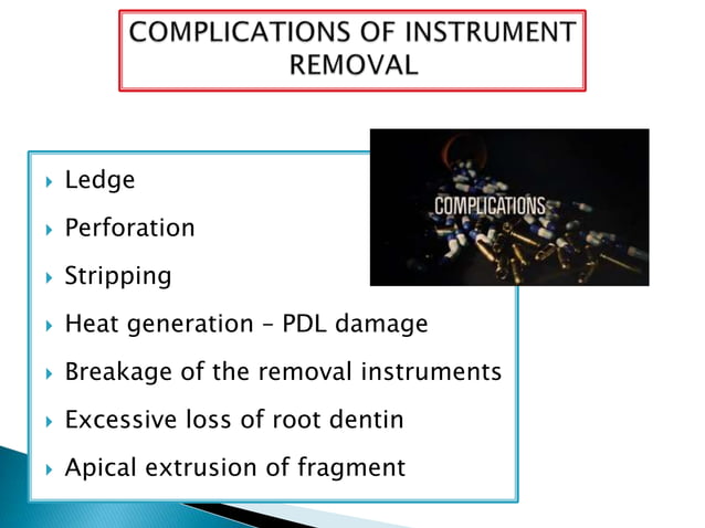 Removal of broken endodontic instruments | PPTX
