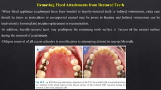 Removal of fixed appliances in orthodontics (dr nayaungbds phd) | PPTX