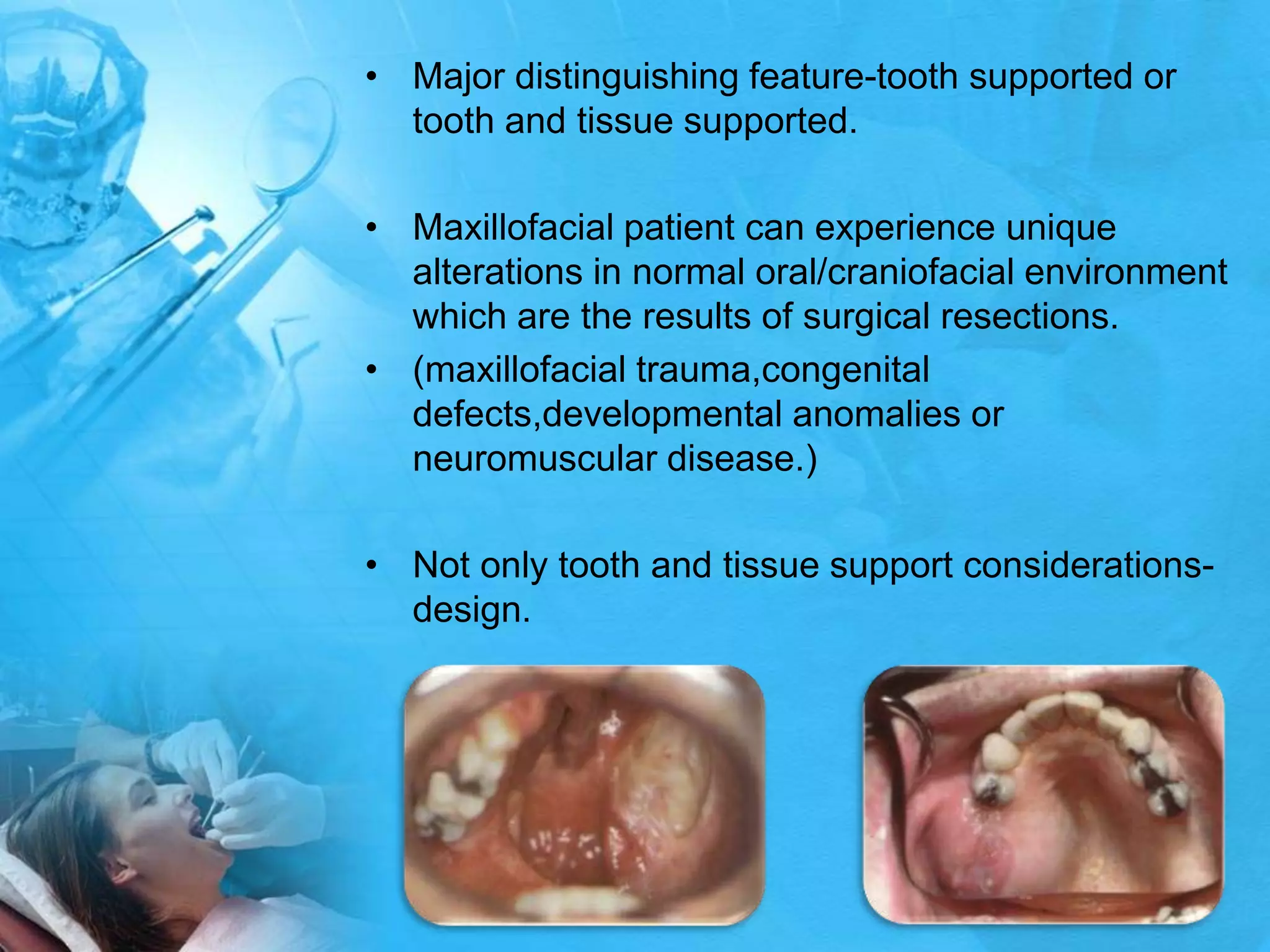Removal partial denture considerations in maxillofacial prosthetics | PPTX