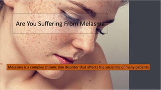 Remove Melasma Spots On Face | PDF