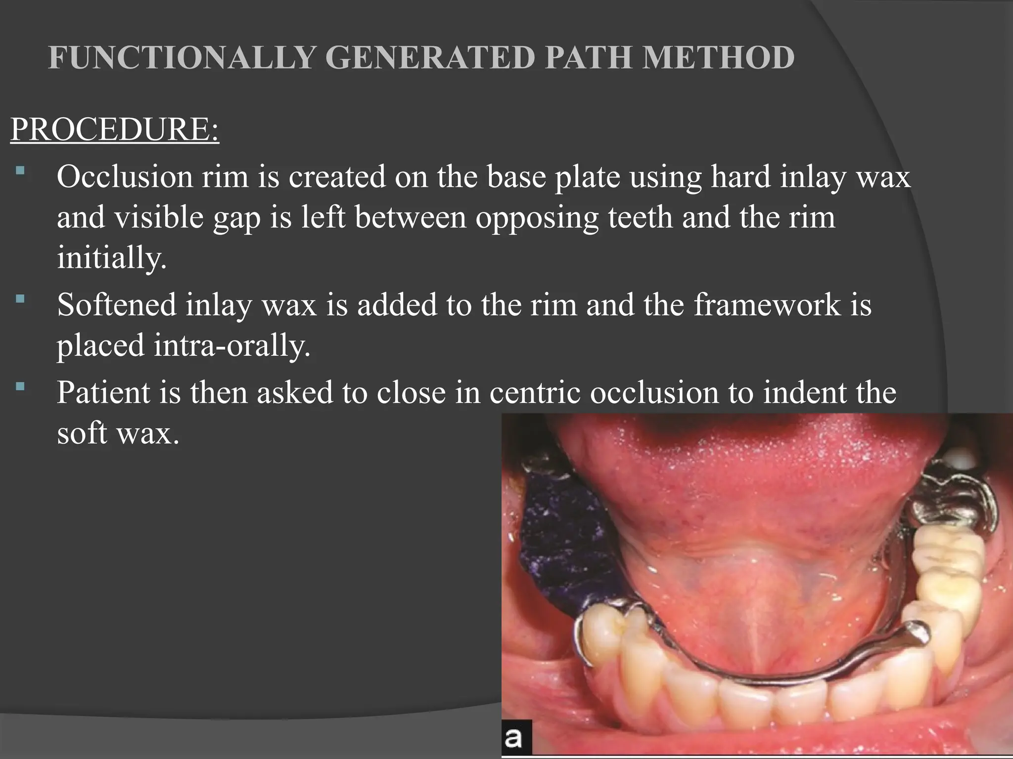 remove occlusionnnnnnnnnnnnn relationnn.pptx