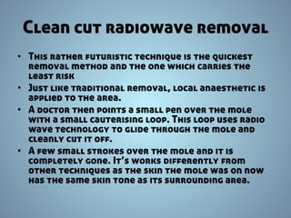 Removing a mole: What they are and how to get rid of them | PDF