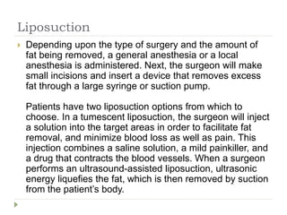 Removing Fat Deposits with Liposuction By Dr. Keith Berman | PPT