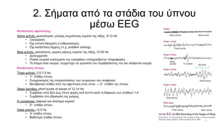 Ύπνος REM | PPT