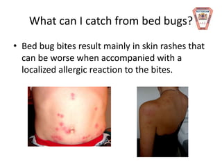 Rems bed bugs | PPTX