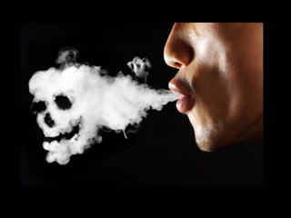 Remya vijayan | PPTX