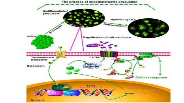Remyelination therapy in ms | PPTX | Brain and Nervous System Disorders ...