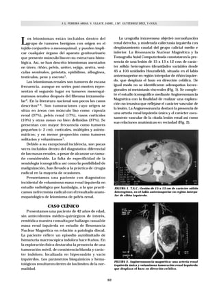 LEIOMIOMA RENAL VOLUMINOSO | PDF