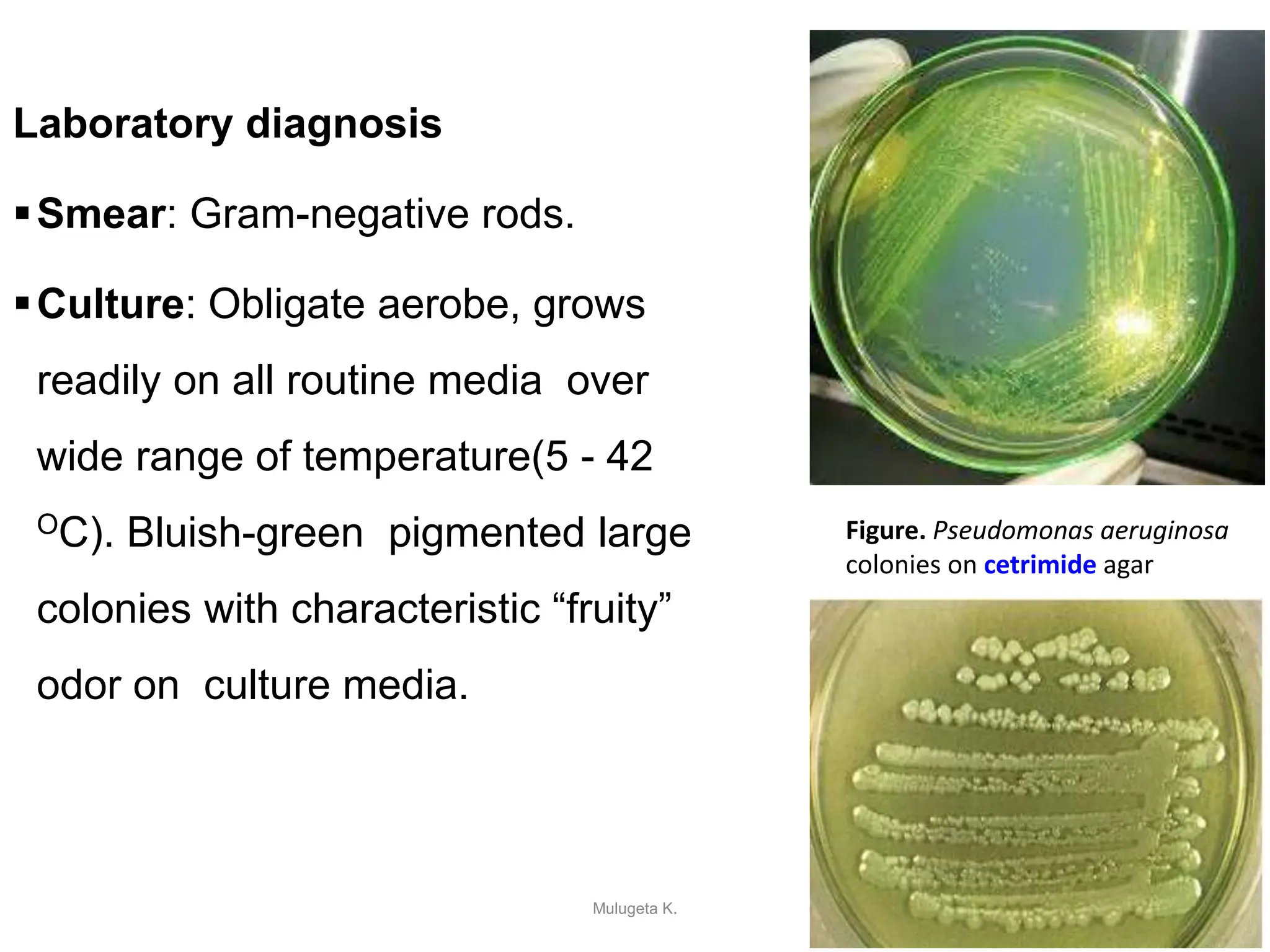 Explain brief anatomical structure and function of renal system Discuss ...