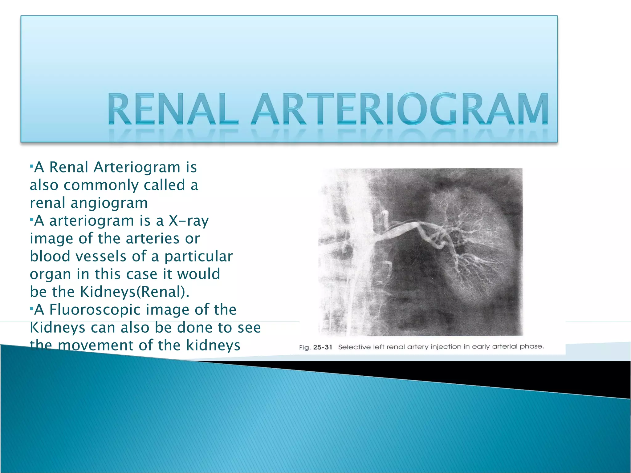 Renal Arteriogram | PPT