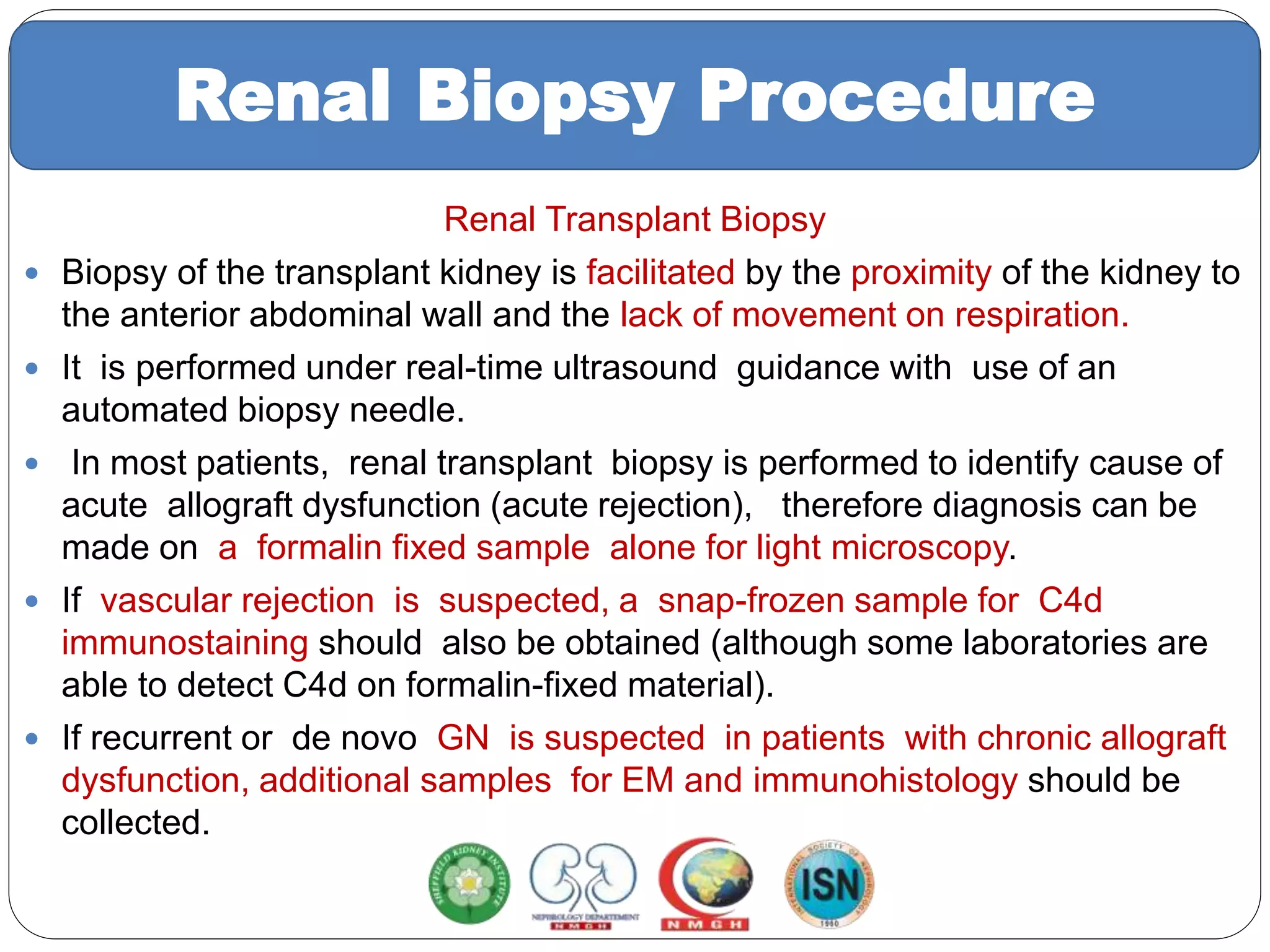 Renal biopsy | PPT