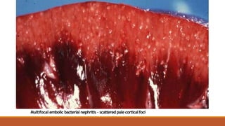 renal-pathology.pptx
