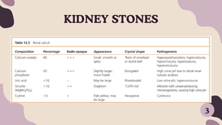 Nephrolithiasis, pathophysiology and types | PDF