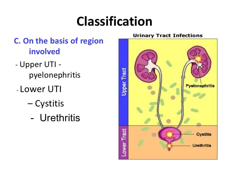 Urinary Tract Infections
