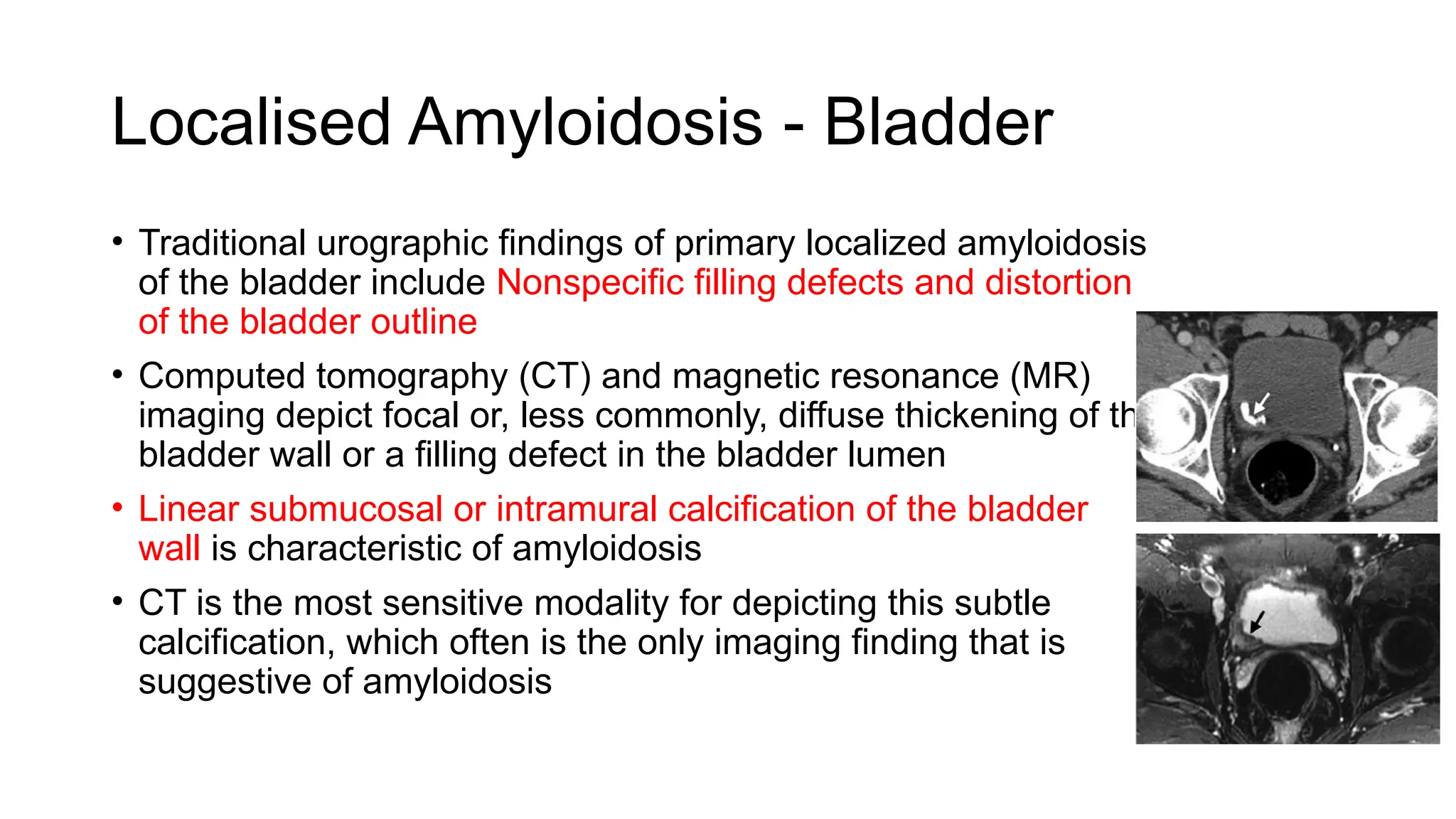 Renal Amyloidosis a in-depth review.pptx