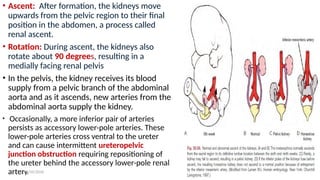 RENAL ANAMOLY PPT 2025.pptx anatomical renal abnormilities.RENAL ...