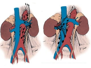 Renal anatomy | PPTX