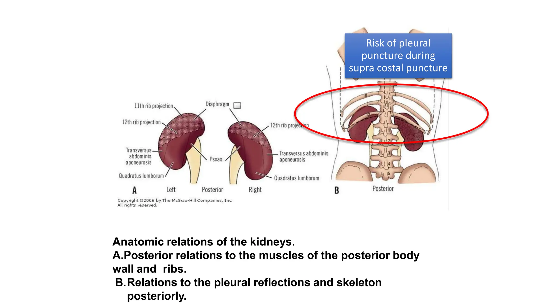 Renal Anatomy - applied aspects | PPTX