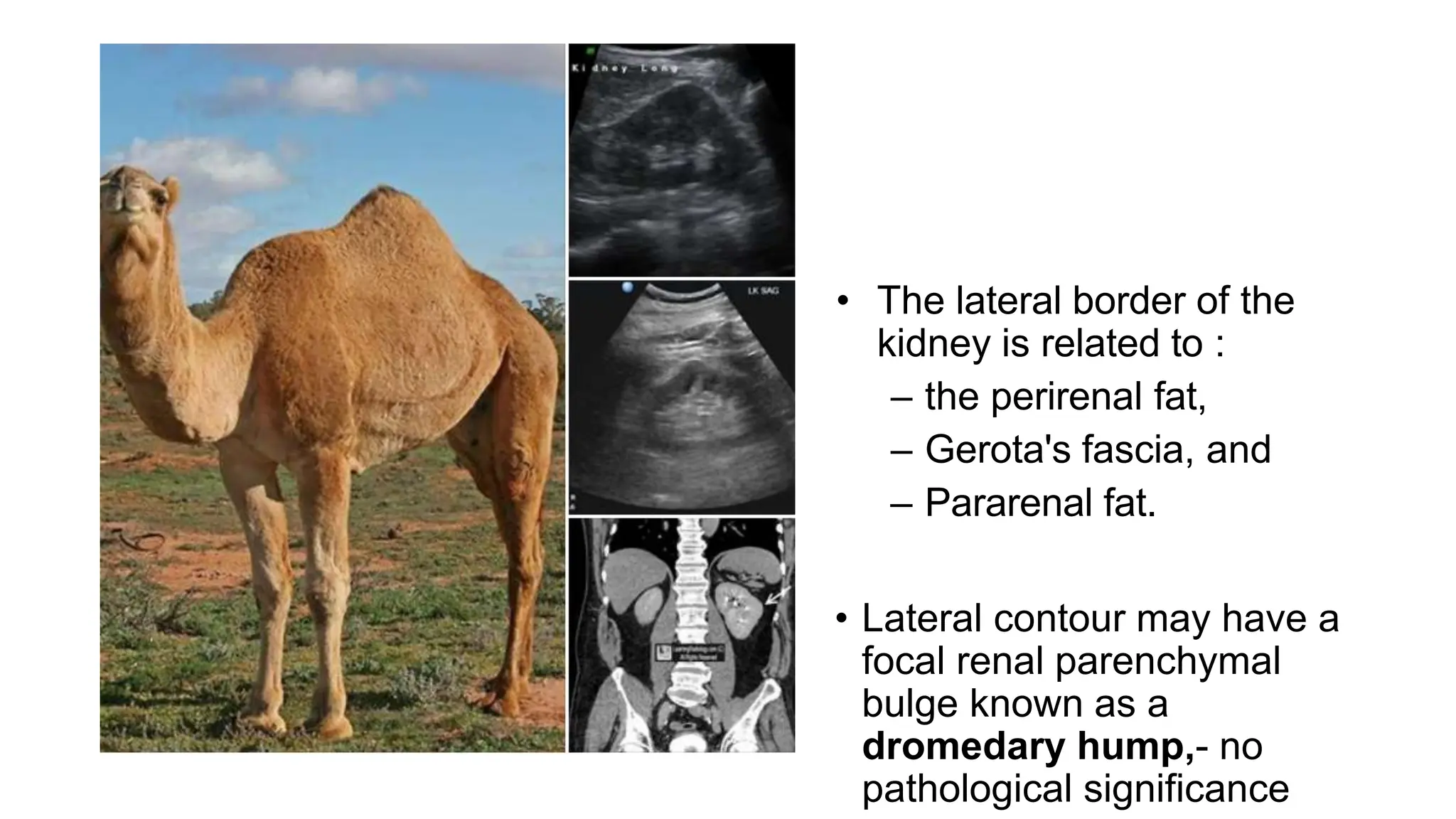 Renal Anatomy - applied aspects | PPTX