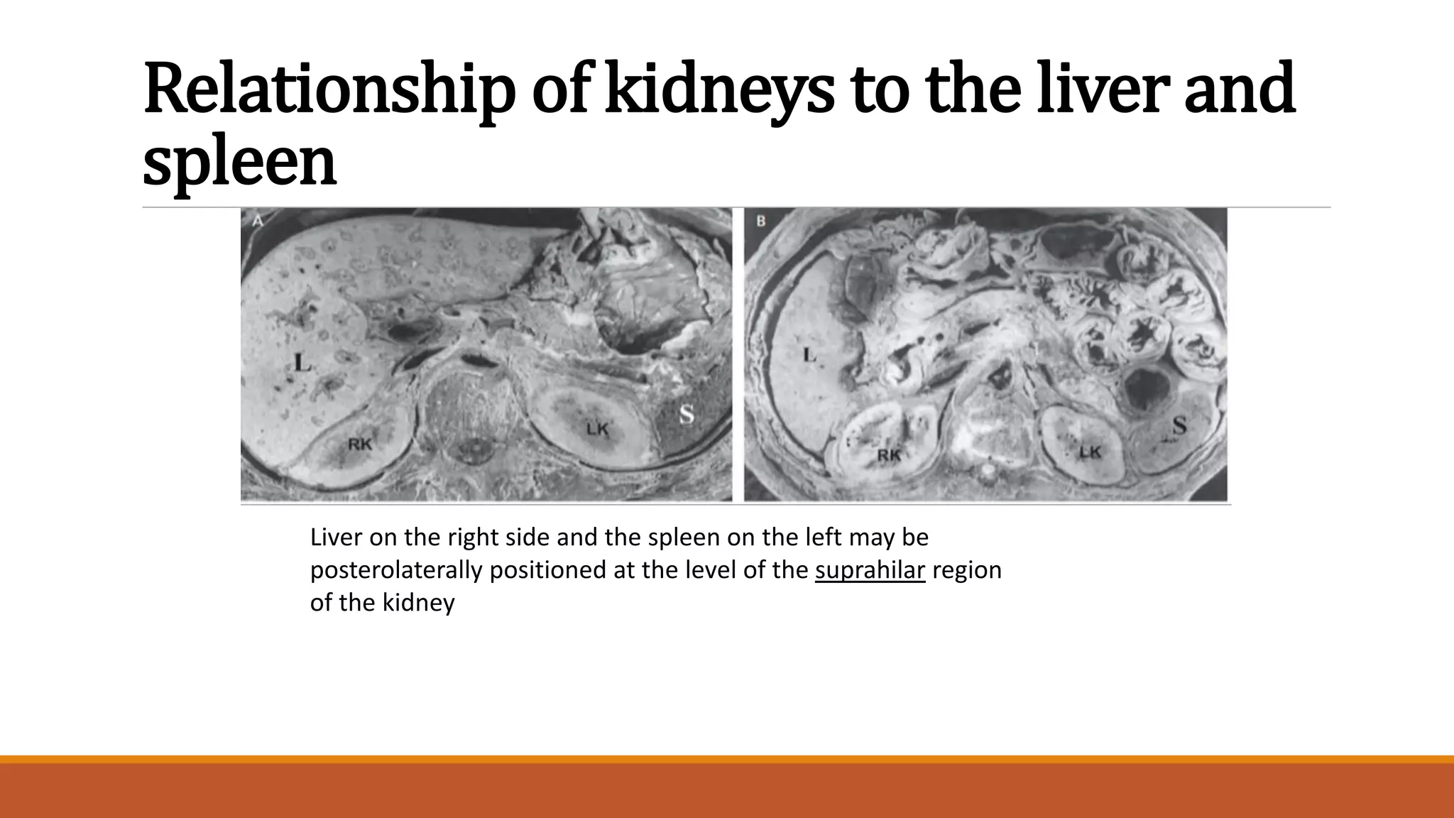 RENAL ANATOMY2.pptx