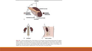 RENAL ANATOMY2.pptx