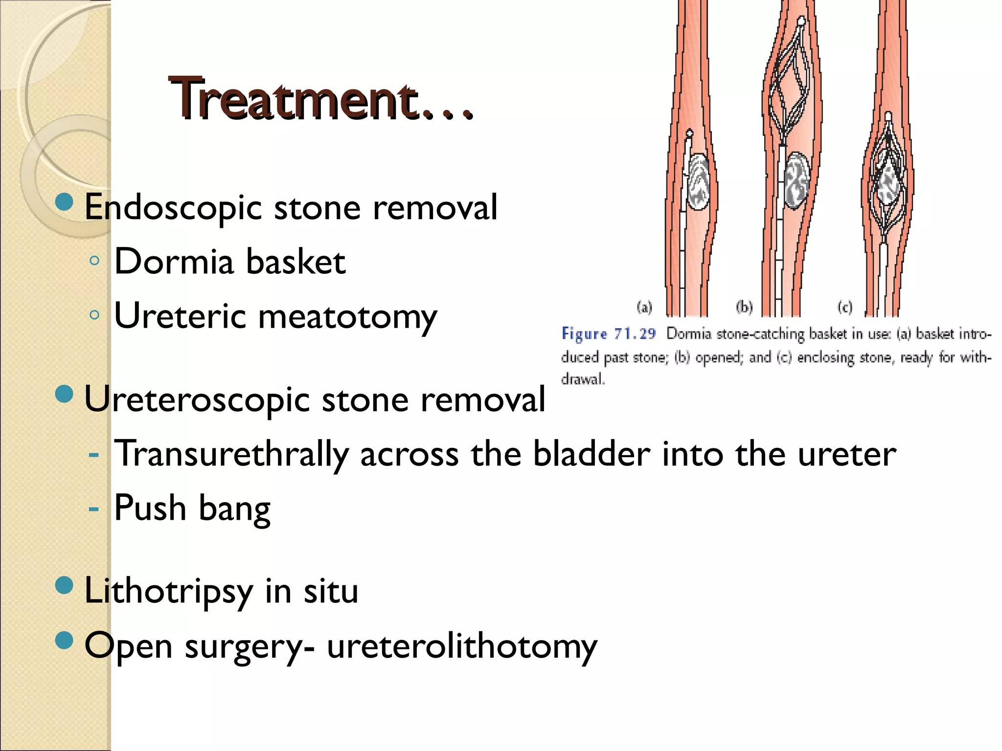 Renal and bladder stones by Sunil Kumar Daha | PPT