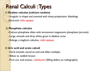 Renal and bladder stones by Sunil Kumar Daha | PPT