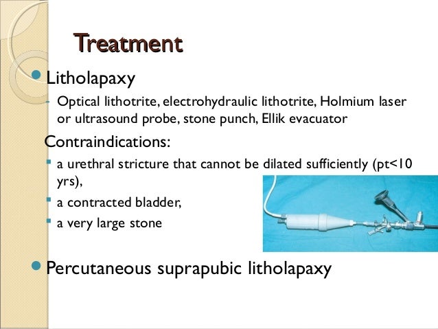 Renal and bladder stones by Sunil Kumar Daha