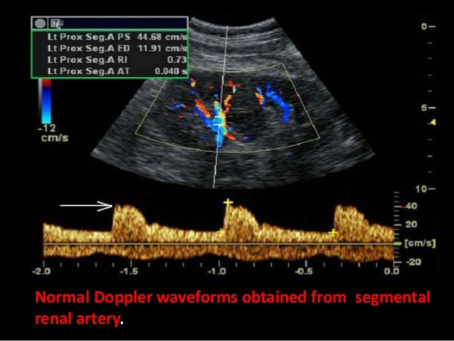 Renal and testicular doppler