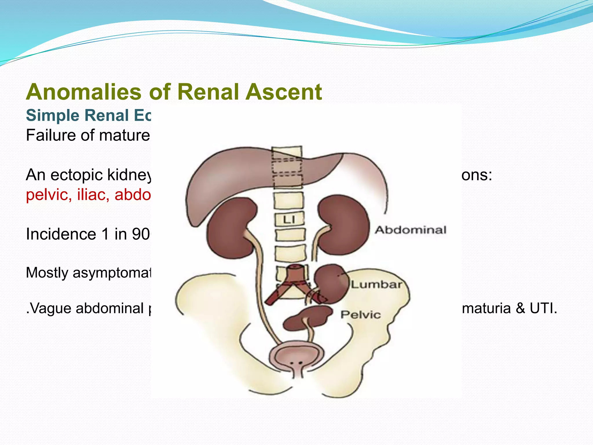 Renal anomalies | PPTX