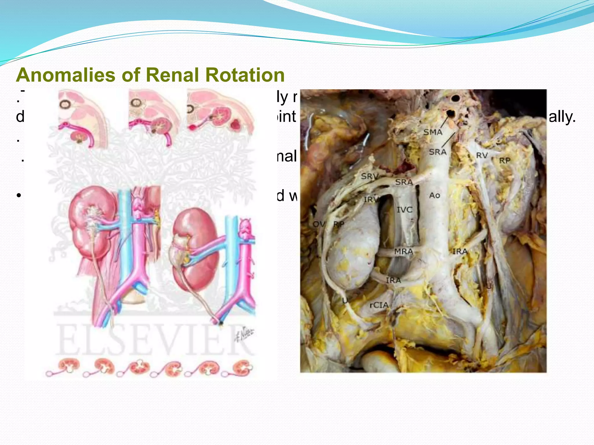 Renal anomalies | PPTX